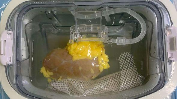 Prekretnica u transplantaciji organa: Naučnici na korak do univerzalnog ...