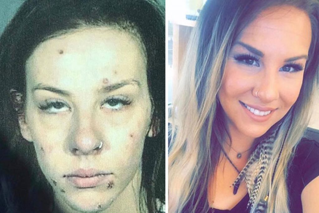 Nevjerovatne fotografije ovisnika koji su se skinuli s droga